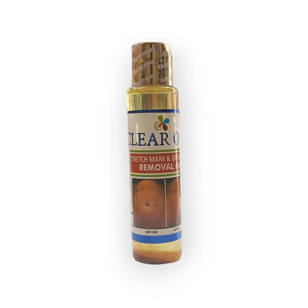 CLEAR OFF STRETCH MARK & GREEN VEIN OIL – Slique Beauty Limited